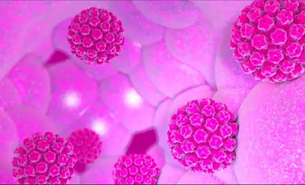 ¿Qué es el VPH y cómo prevenirlo? - Red Uno de Bolivia