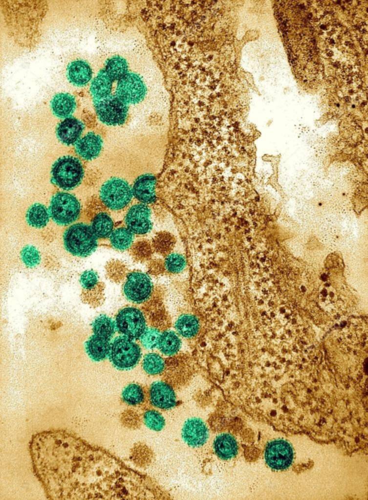 Como prevenir el virus Machupo